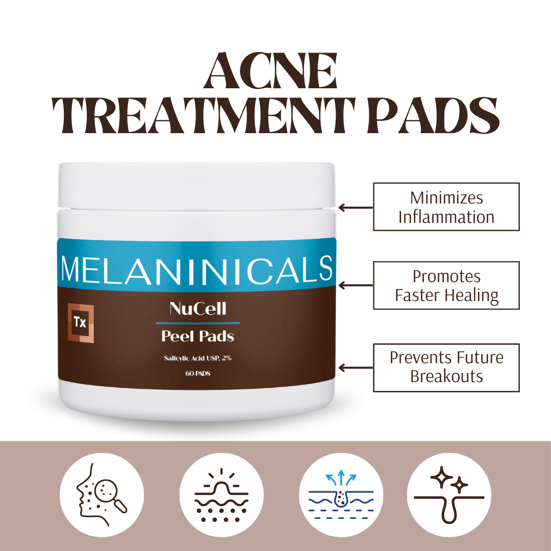 Acne Treatment Pads – Exfoliating & Cleansing Pads for Clear Skin | K ...